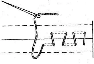 Schwarz-Weiß-Zeichnung der Erfüllung einer geheimen Naht vom Gesicht und im Inneren des Gewebes, wo die Stiche auf der beteiligten Seite angezeigt werden
