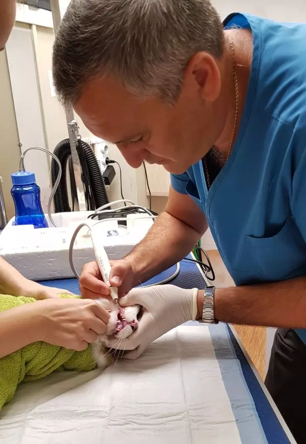 Ultrasone tandheelkundige verwijdering