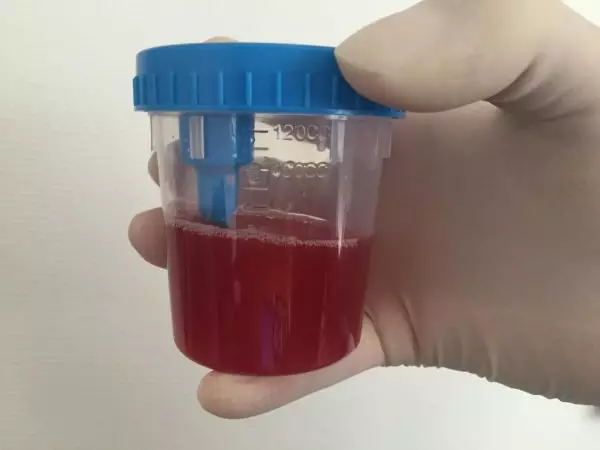 Blood in the urine in cats