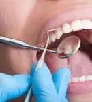 Inspektion af tænder