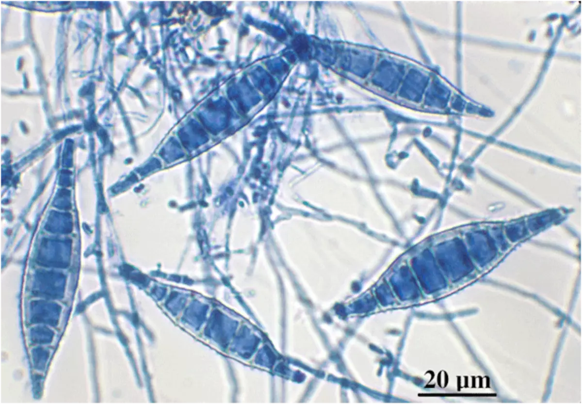 Ўзбуджальнік мікраспарыі Microsporum canis пад мікраскопам