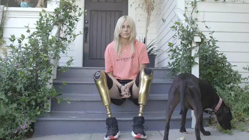 Lauren Wasser: Историята на модела със златни крака
