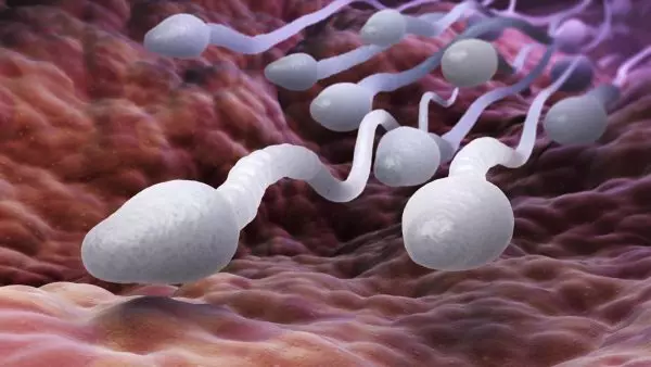 Spermatozoa sing ora aktif