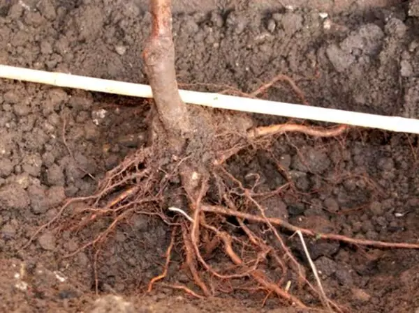 Root cervikale